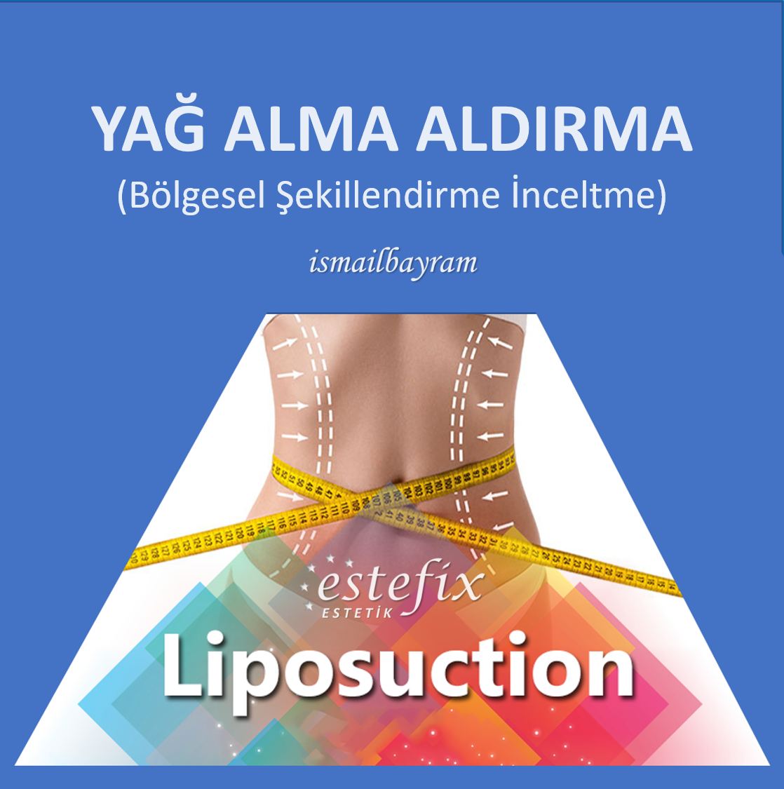Yağ Alma Aldırma Liposuction - Estefix Estetik