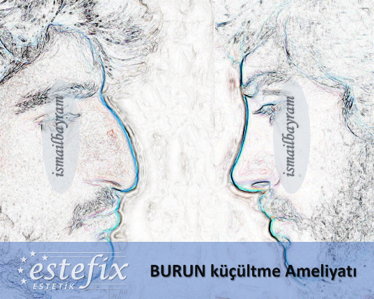 Burun küçültme Ameliyatları - Estefix Estetik