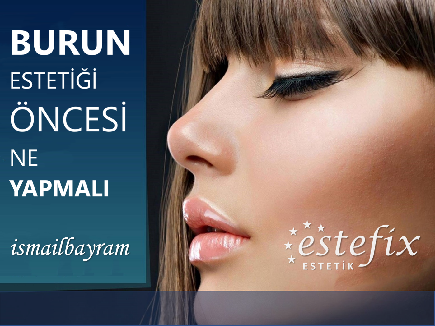 Burun Estetiği Öncesi - Estefix Estetik